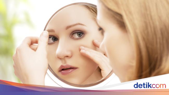 Wajah Gampang Berjerawat Tanda Pantat Juga Mudah Burik?