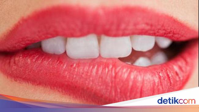 Yuk, Lakukan Cara Berikut Agar Terhindar dari Bibir Berengan