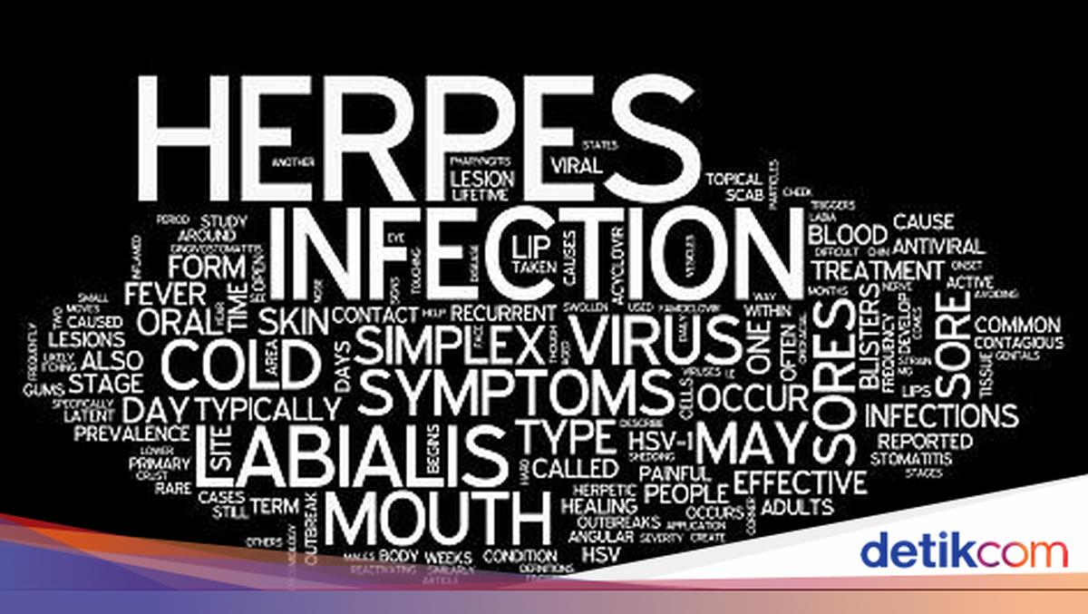 Apa Itu Penyakit Herpes? Kenali Gejala, Penyebab, Pencegahan dan Pengobatannya