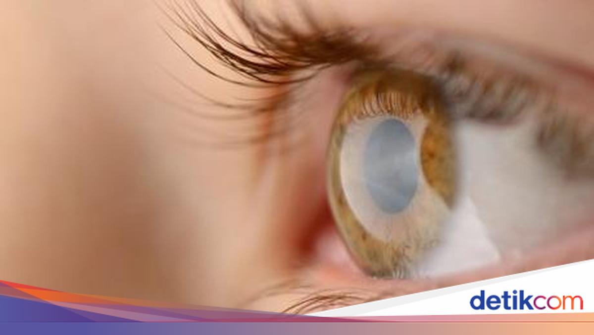 Ketahui Fungsi Pupil Mata dan Sejumlah Gangguannya