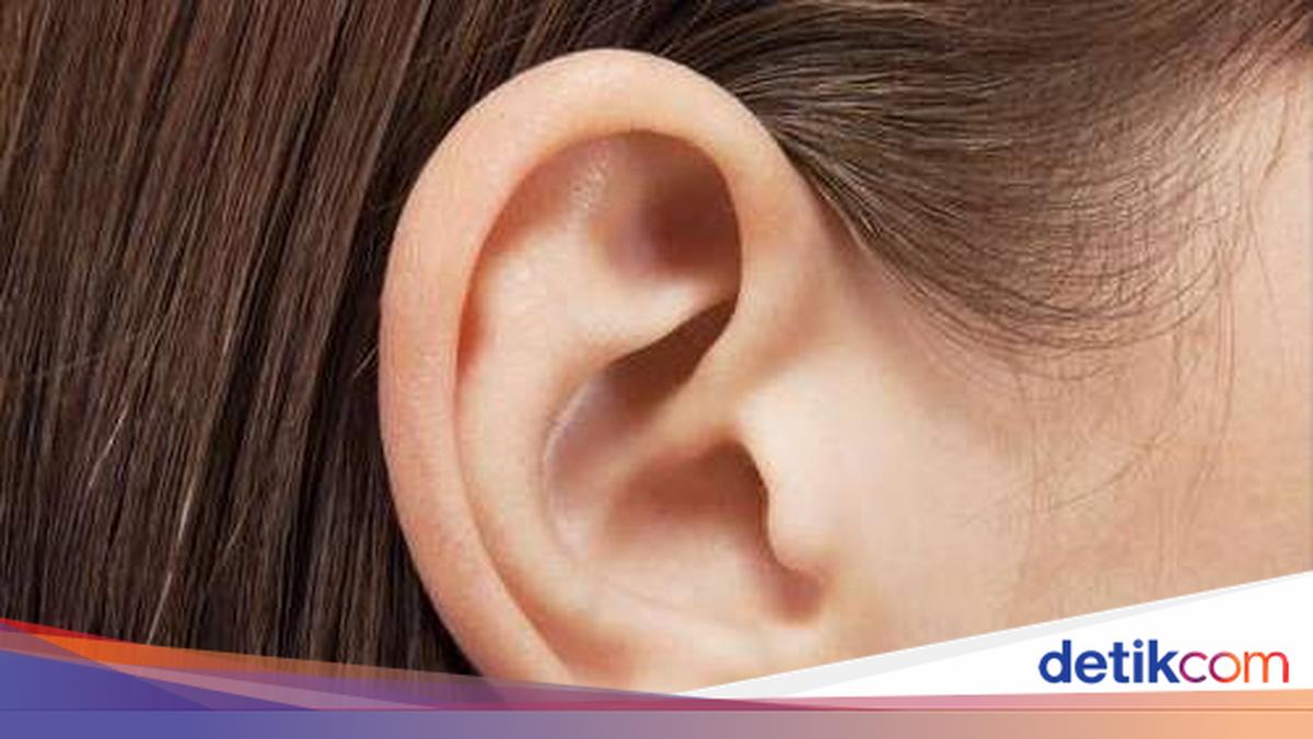 Pertama di Dunia, Dokter Transplantasi Telinga Hasil Cetakan 3D
