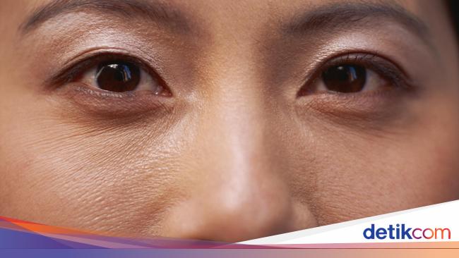 Pertuni: Tiga-perempat Tunanetra adalah Penyandang Low Vision