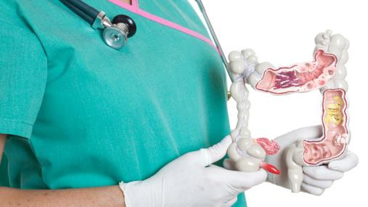 12 Gejala Usus Buntu, dari Nyeri Perut Hingga Sembelit