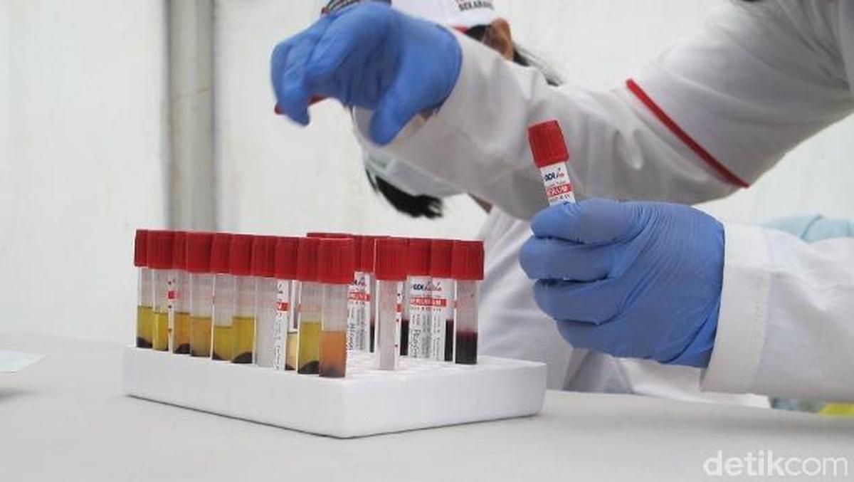 Arti 'Reaktif HIV-Sifilis' Menurut Dokter, Dialami 30 Peserta Pesta Gay di Puncak