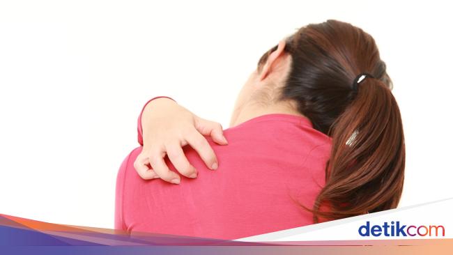 Ramai Curhat Netizen Muncul Ruam 'Aneh' di Punggung, Diduga Ringworm