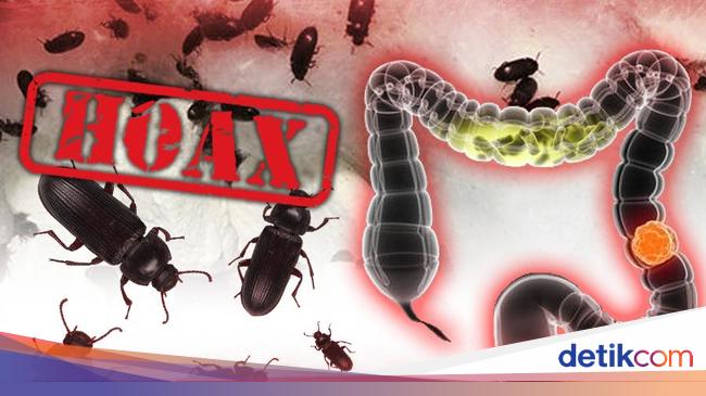 Broadcast Semut Jepang Jadi Obat Diabetes, Namun Membahayakan Usus