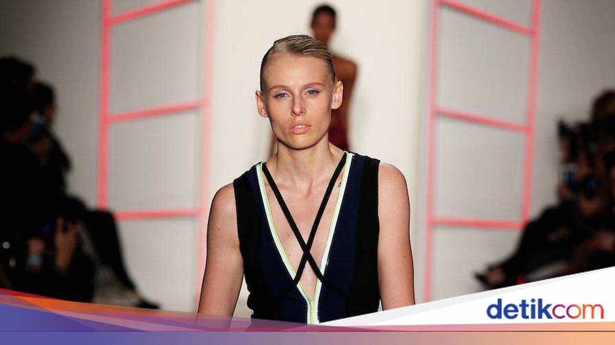 Model dengan Kaki Amputasi Tampil di New York Fashion Week