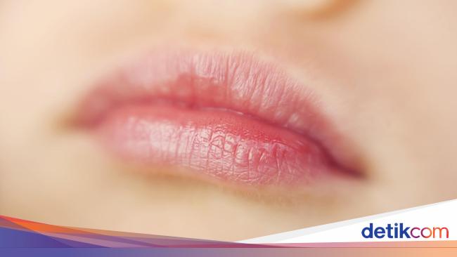 Tips Atasi Bibir Kering Saat Berpuasa