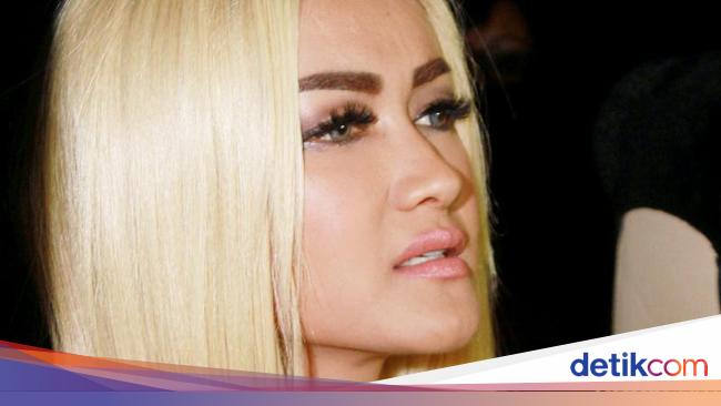 Botak, Jupe Tetap Gaya dengan Wig Pirang