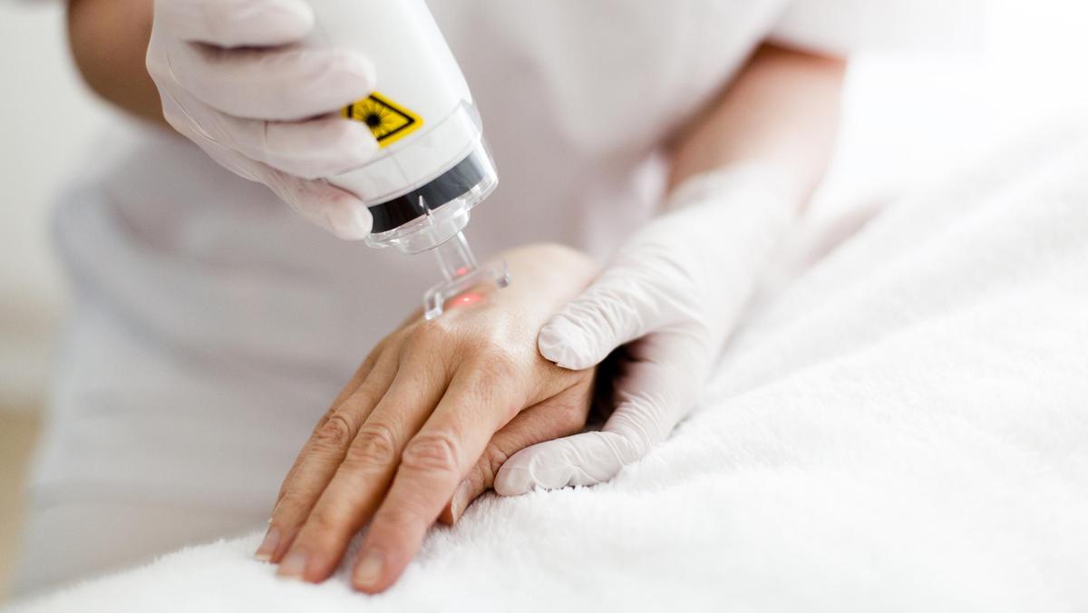 Yuk Ketahui Cara Kerja Terapi Laser untuk Bantu 'Hilangkan' Tato