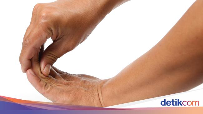 Kenali, Gejala Trigger Finger yang Bikin Muncul Bunyi 'Klik' Saat Jari ...