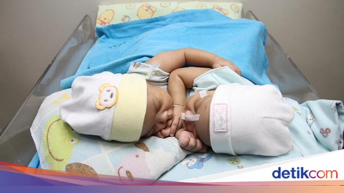 Gesya Bayi Kembar Dempet Dada Meninggal di RSHS Bandung