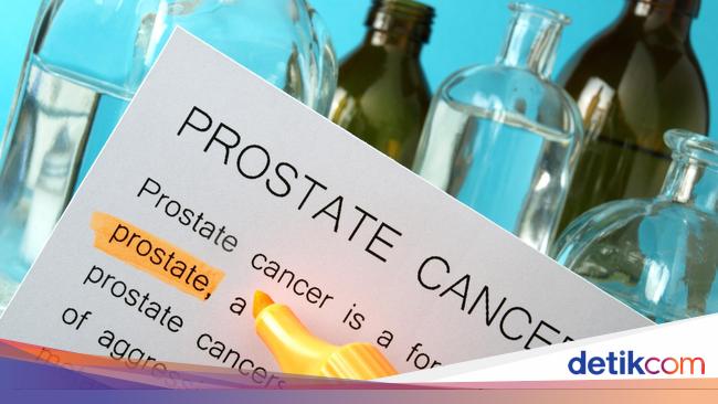 Tanda-tanda Kanker Prostat yang Sering Diabaikan, Cek Sekarang!