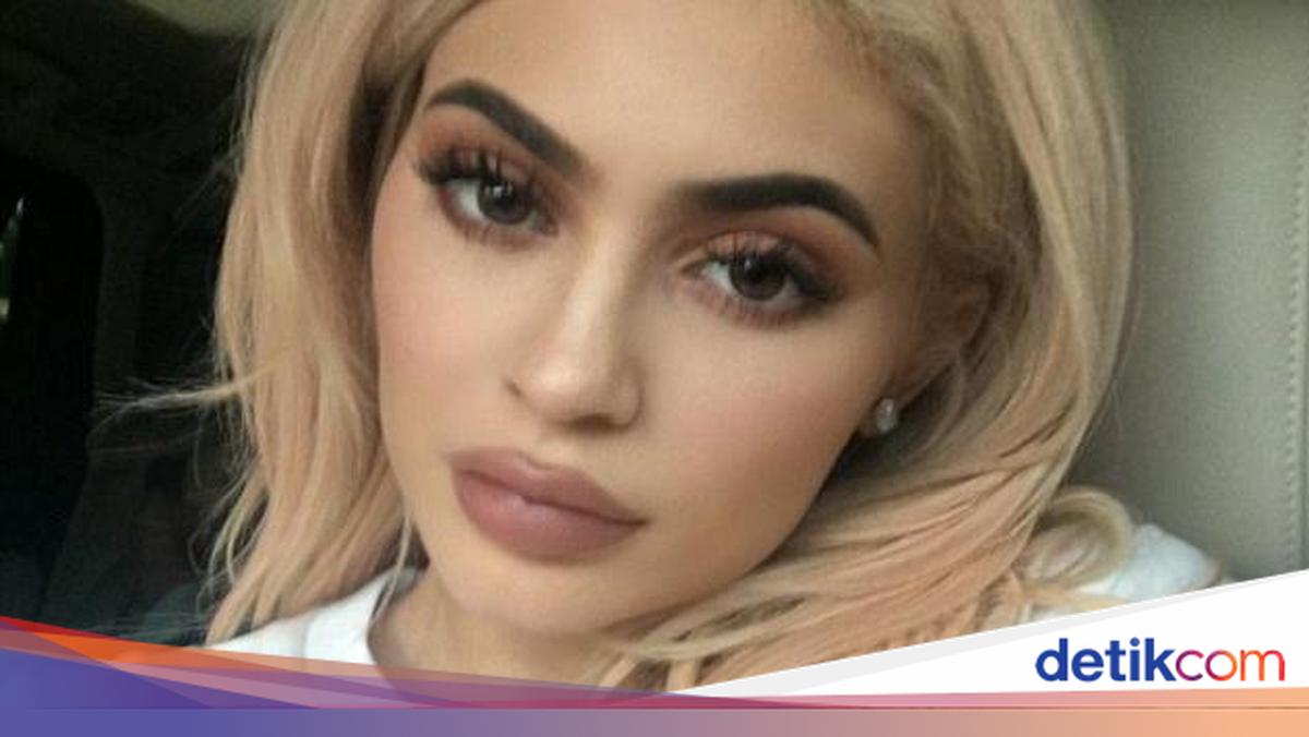 Bukan Seperti Kylie Jenner, Ini Bentuk Bibir Sempurna Menurut Dokter