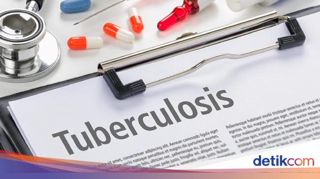 Kenali Gejala TBC pada Orang Dewasa dan Anak-anak