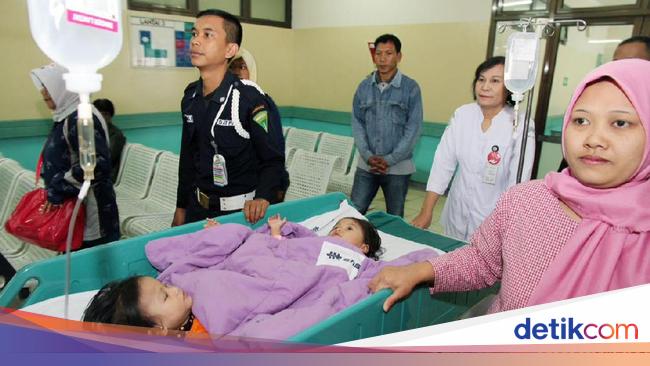 Bayi Kembar Siam Dempet Pinggul Asal Sumedang Jalani Operasi Pemisahan ...