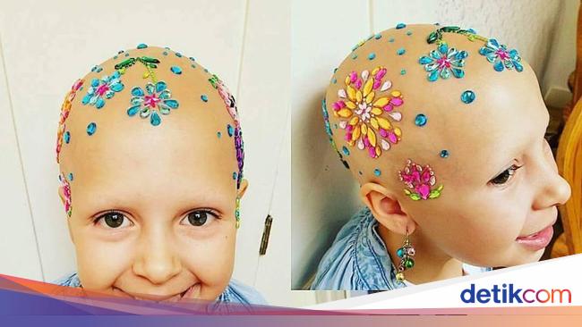 Anak Perempuan Ini Buktikan Bisa Tetap Cantik dengan Kepala Botak