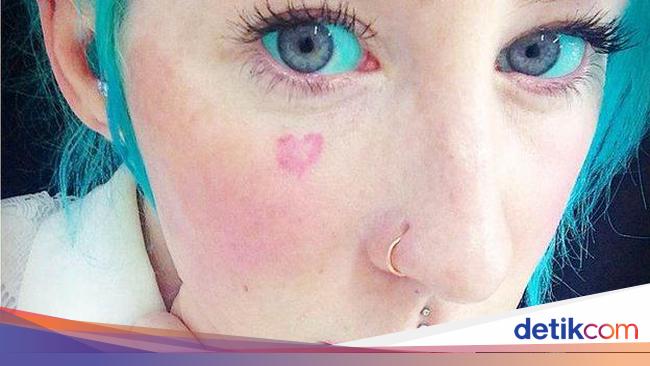 Sejarah Tato Mata, Sudah Dipraktikkan Sejak Dulu untuk Pasien