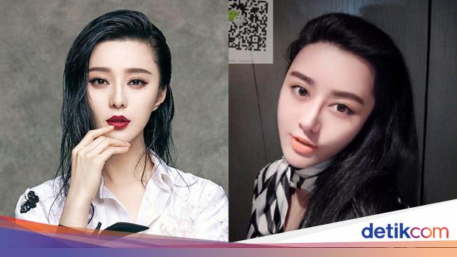 Kata Dokter Soal Wanita yang Operasi Plastik Demi Mirip Fan Bingbing
