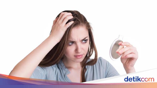 6 Penyebab Uban di Usia Muda dan Cara Mengatasinya