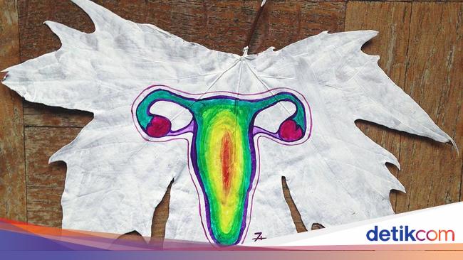 Mengenal Strecth Mark dan Solusi Mengatasinya