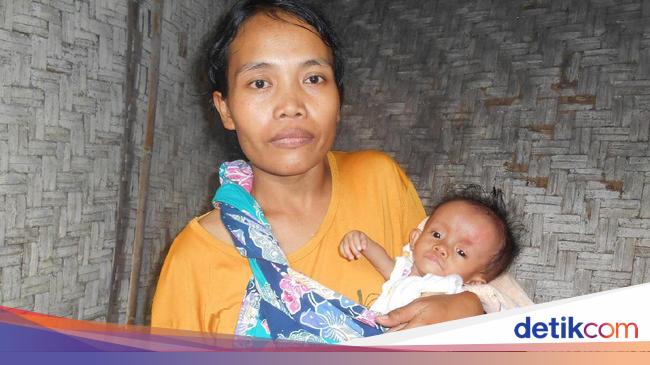 82 Anak di Kabupaten Blitar Alami Gizi Buruk