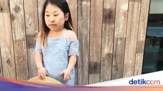 Bertubuh Kerdil Tapi Stylish Fashion Blogger Korea Selatan Ini Viral