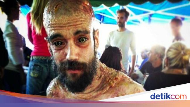 Potret Monster yang Diperankan Javier Botet, Si Penyandang Sindrom Marfan