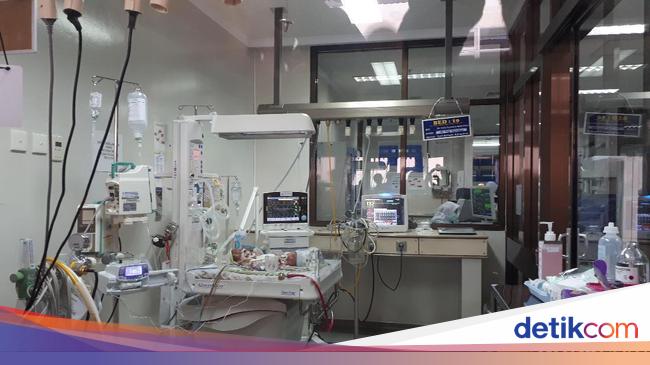 RSHS Bandung Rawat Bayi Kembar Siam Dempet Perut dan Pinggul