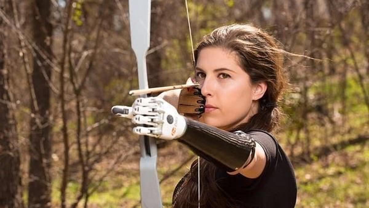 Angel Giuffria, Wanita Cantik dengan Lengan Prostetik yang Rajin Olahraga