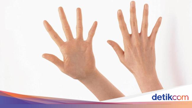 Wanita yang Jari Telunjuknya Lebih Panjang dari Jari Manis, Suka Selingkuh?