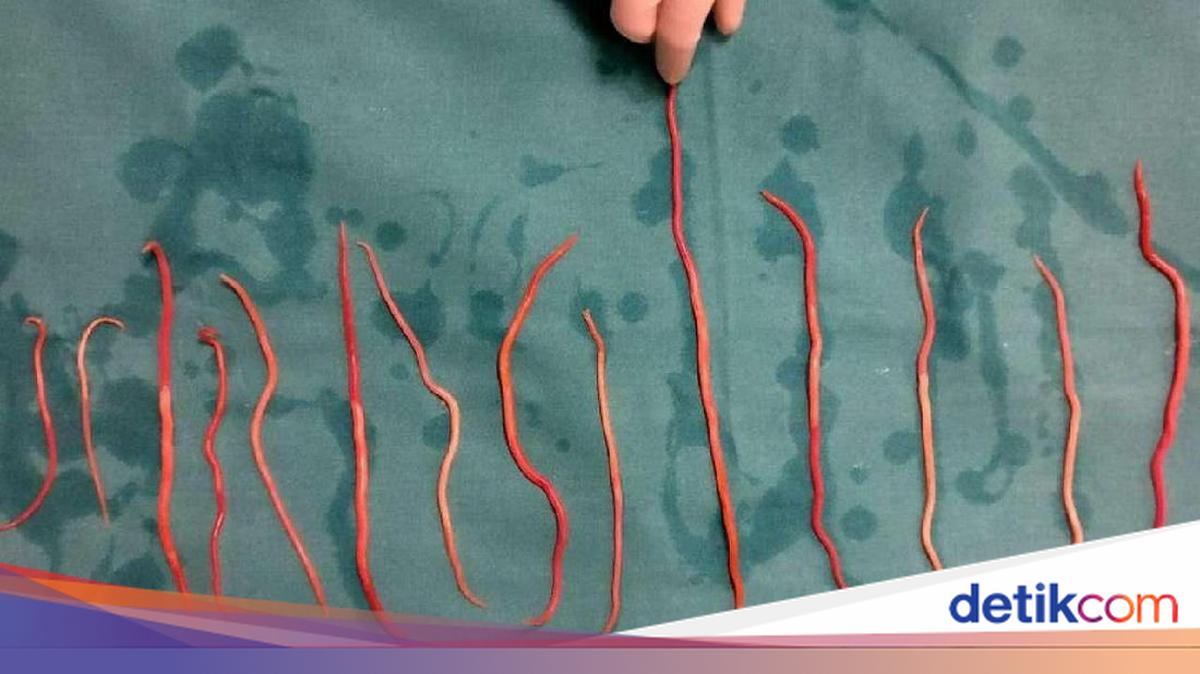 Raya Meninggal Usai Tubuh Penuh Cacing, Sang Ibu: Ada yang Ukuran Sekilo