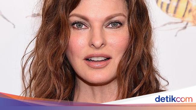 Pernah Jadi Korban Oplas Gagal, Linda Evangelista Masih Rutin Suntik Botox