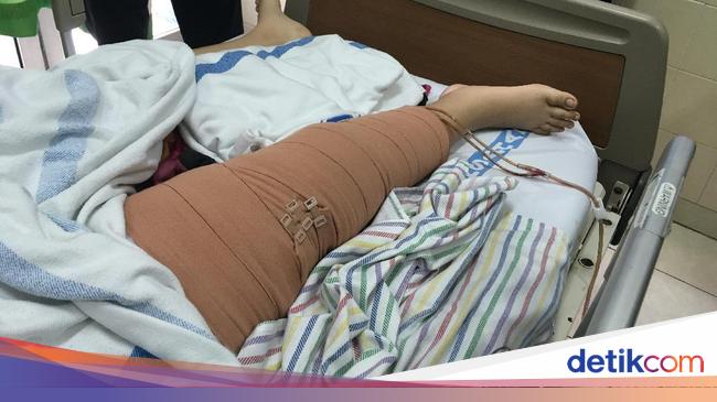 Kanker Tulang: Penyebab, Gejala, Jenis, dan Cara Pengobatannya