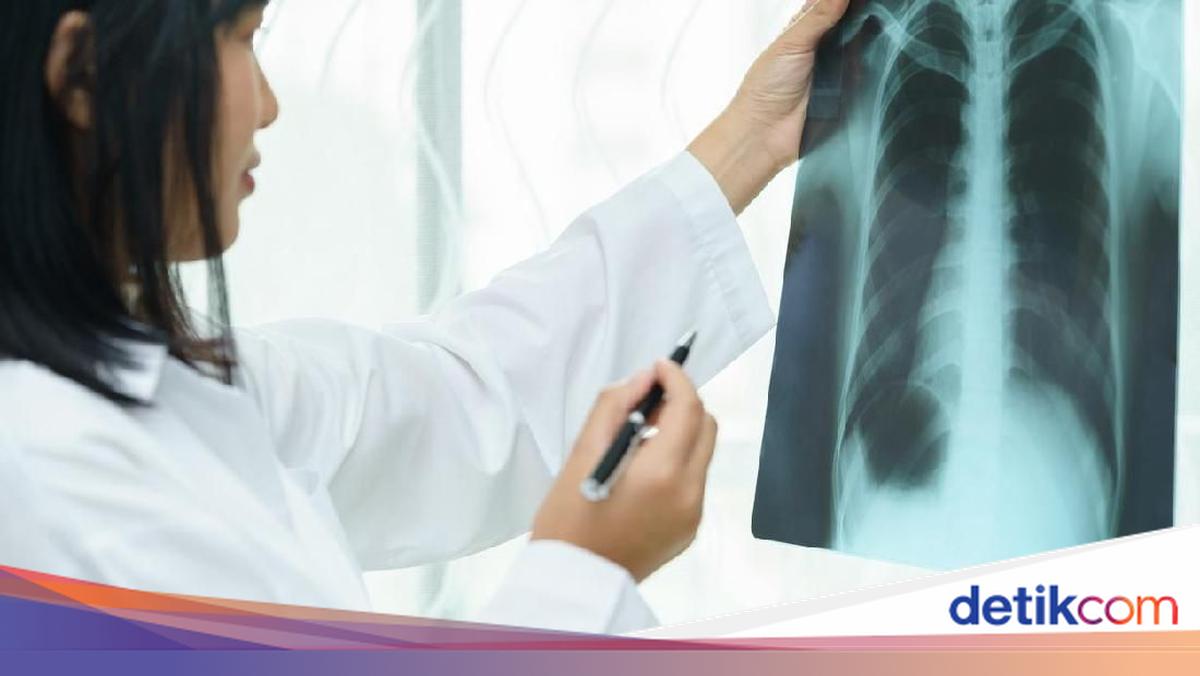 15 Gejala Infeksi Paru-paru, Penyebab, dan Cara Mengobatinya