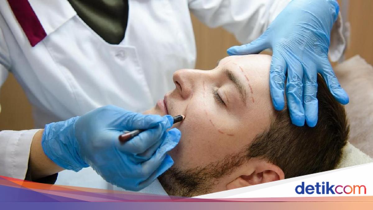 Apa Itu Filler? Ini Jenis, Manfaat, Efek Samping, Prosedur, dan Tipsnya