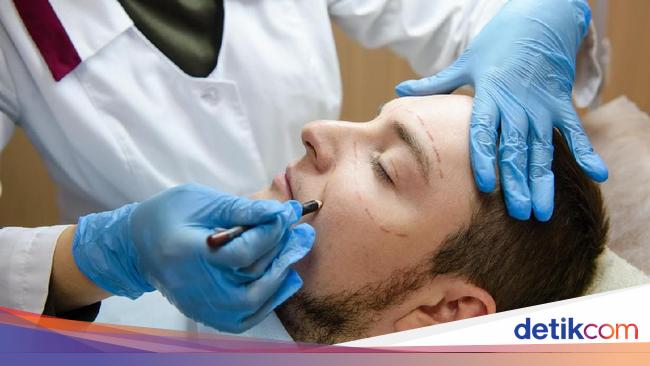Apa Itu Filler? Ini Jenis, Manfaat, Efek Samping, Prosedur, dan Tipsnya
