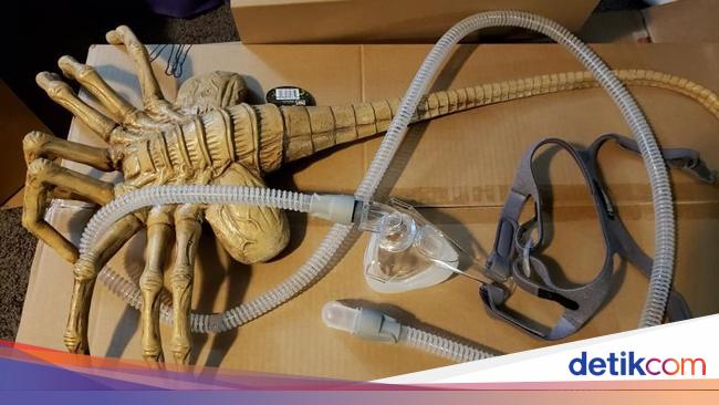 Potret Ketika Alat CPAP Diubah Jadi Alien Facehugger