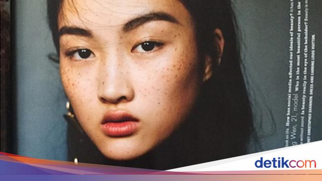 Potret Li Jingwen, Model Zara yang Jadi Viral Gara-gara Freckles