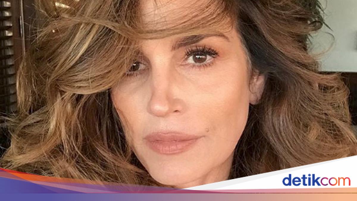 10 Artis Ngaku Terang-terangan Suntik Botox dan Filler, Begini Wajah Mereka