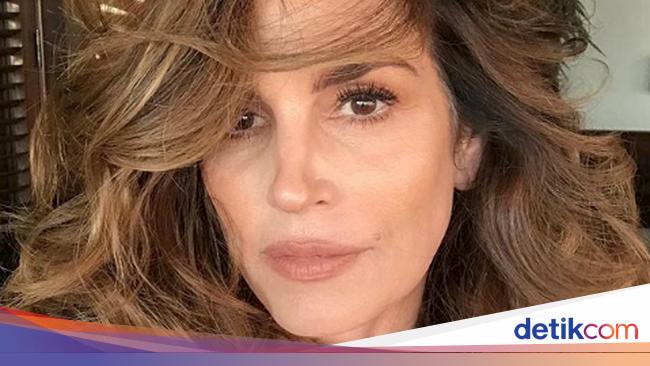10 Artis Ngaku Terang-terangan Suntik Botox dan Filler, Begini Wajah Mereka