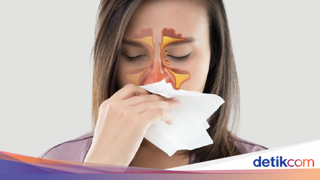 Gejala, Pencegahan, dan Cara Pengobatan Sinusitis