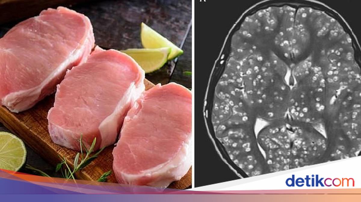 Makan Daging Babi Setengah Matang, Remaja di India Ini Kehilangan Nyawanya