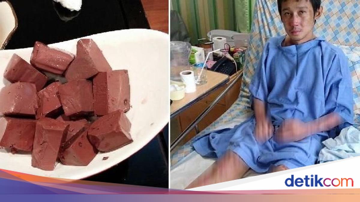 Terinfeksi Patogen Dalam Dadih Darah Babi, Pria Ini Diamputasi Kedua ...