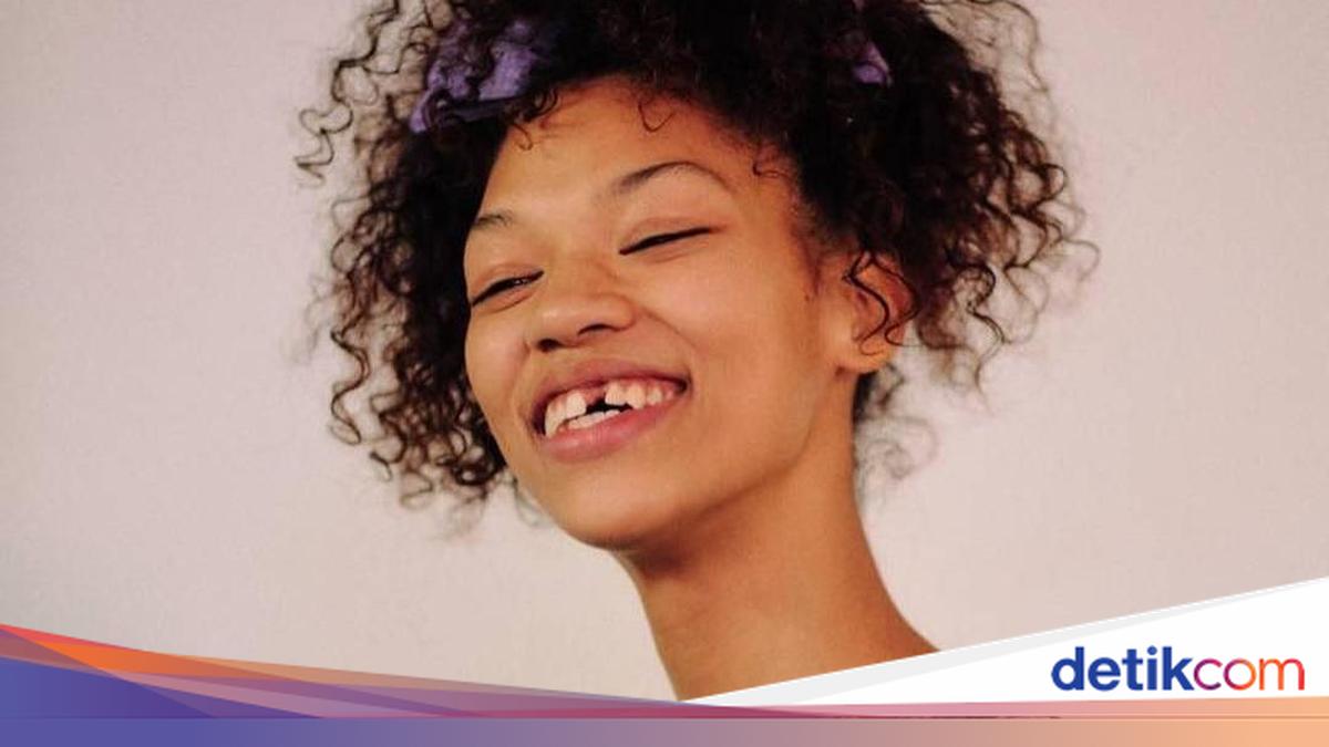 Potret Symone Lu, Model yang Jadi Terkenal karena Punya Gigi Ompong