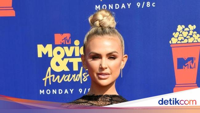 Foto: Si Seksi Lala Kent, Artis yang Pernah Dituduh Pelakor dan Candu Botox