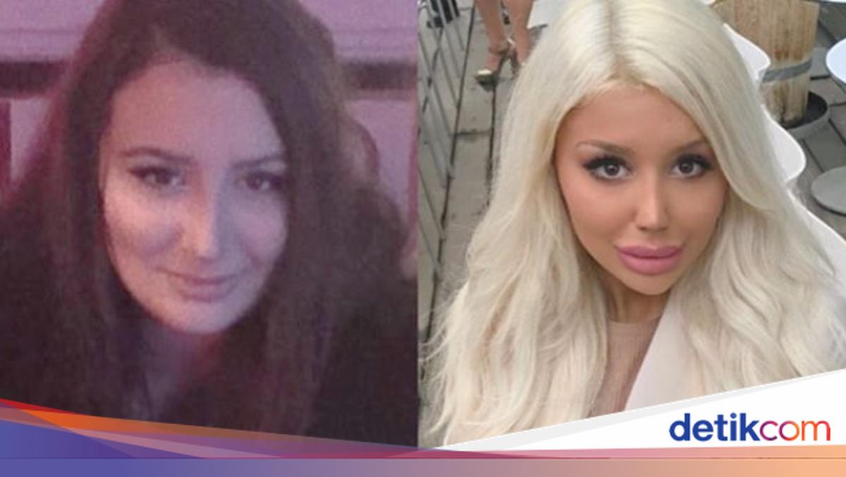 Penampilan Gadis Swedia Sebelum dan Setelah Terobsesi Jadi Barbie