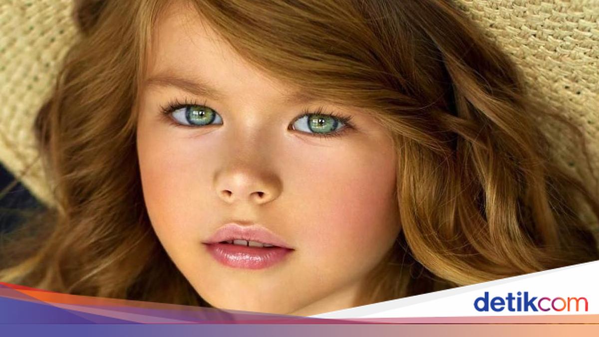 Foto: Pesona Gadis Paling Cantik di Dunia yang Bikin Netizen Gemas
