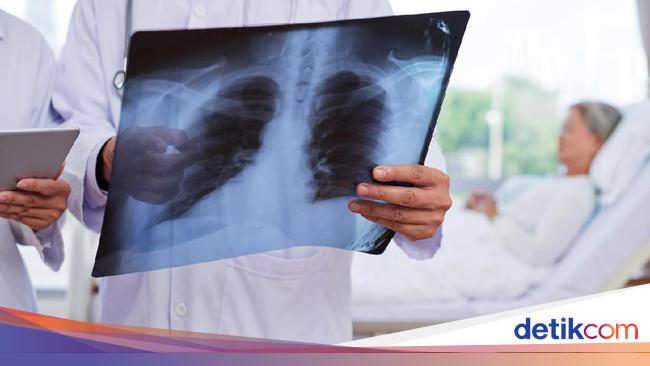 Apa Itu Pneumonia? Begini Penjelasannya