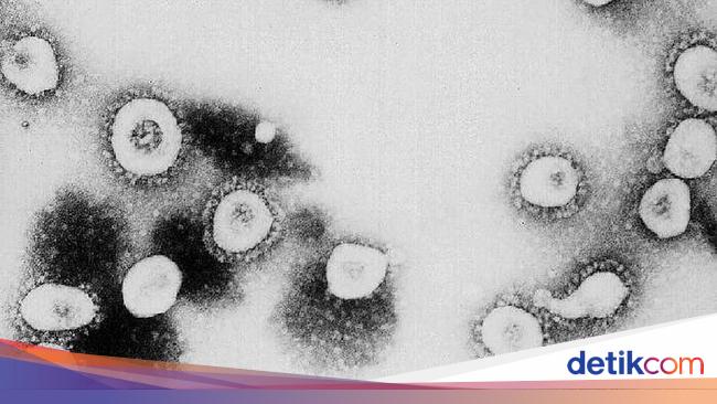 Kata Kemenkes Soal Kemungkinan Virus Corona Masuk Indonesia Tapi Tak ... Kata Kemenkes Soal Kemungkinan Virus Corona Masuk Indonesia Tapi Tak ...